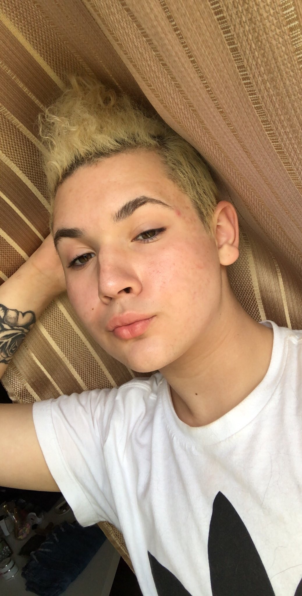 18岁男孩“雌雄同体”，有两套生殖器官，人工受孕成为一个男妈妈_Mikey