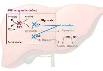 Oxlumo（lumasiran）用于治疗原发性高草酸尿症1型获FDA批准_研究