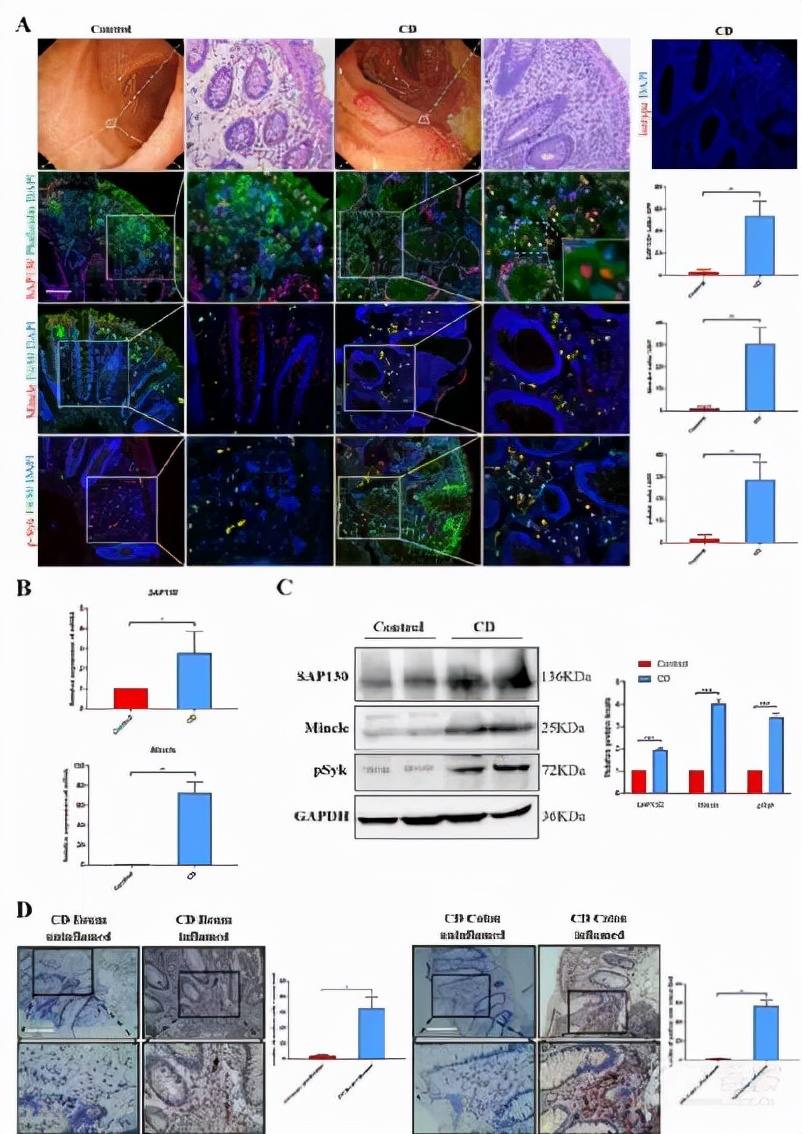细胞焦亡的研究方法——高分文献解读_Mincle_世卫组织_克罗恩