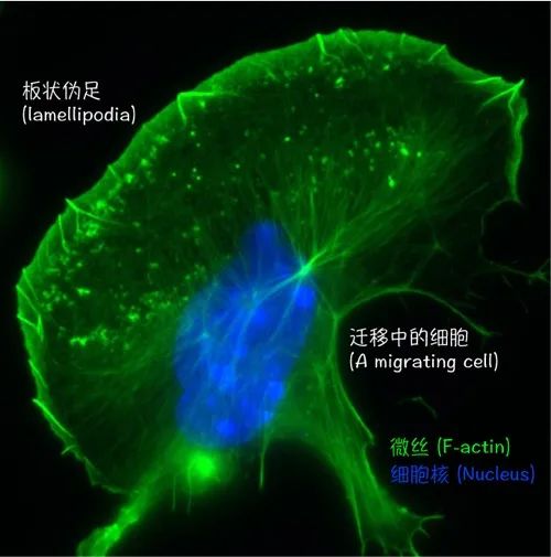 文献解读：Sci Adv & Nat Commun | 揭示肌动蛋白骨架调节新机制_细胞_控制