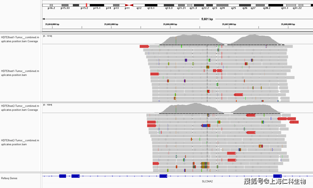 IGV快速上手指南（四）——查看基因融合_reads_位置_进行