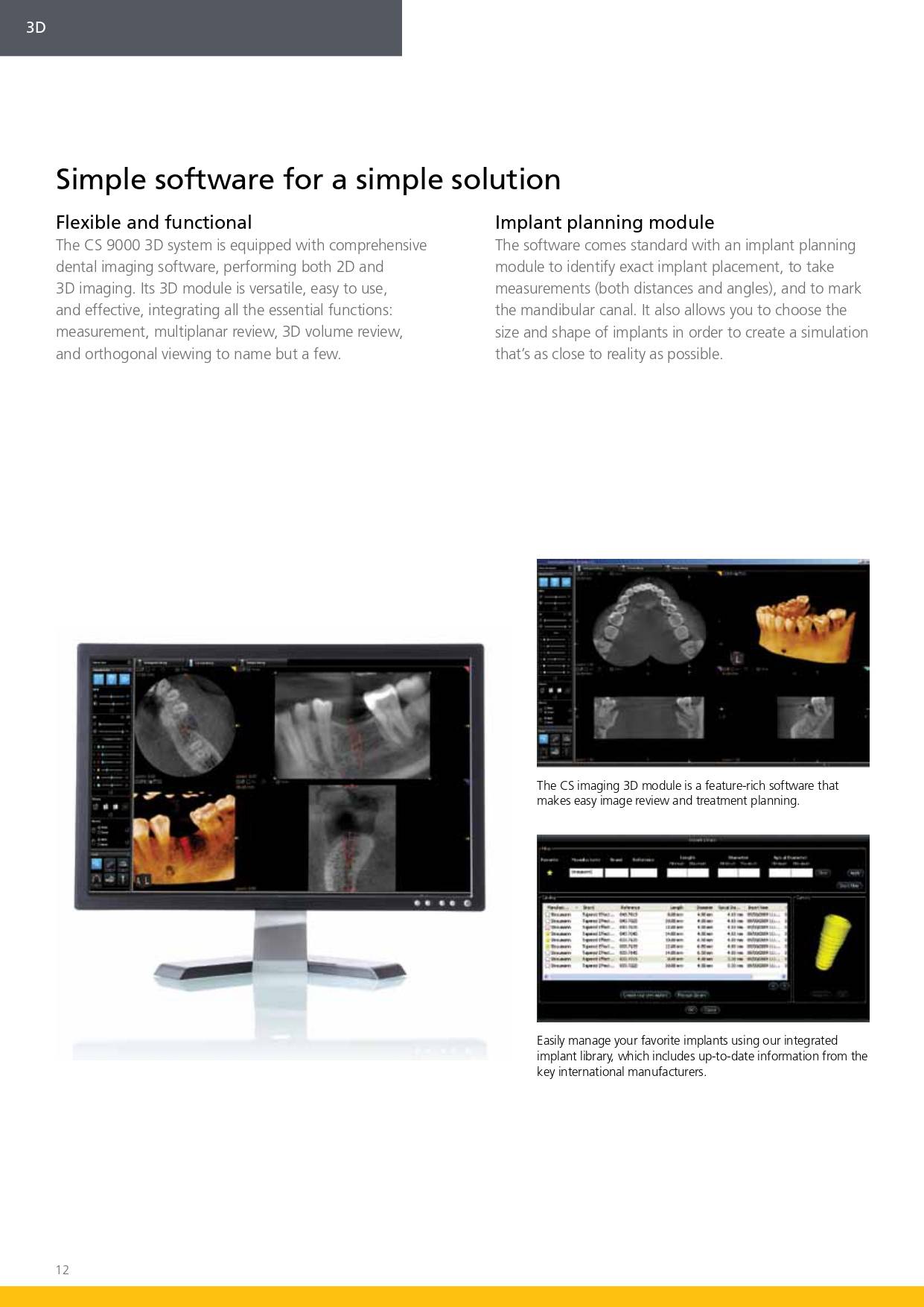 Carestream 9000-搜狐大视野-搜狐新闻
