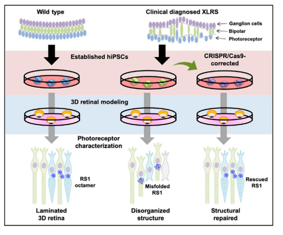 X连锁视网膜劈裂患者的3D视网膜类器官模型研究_hiPSCs