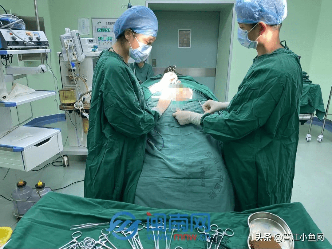 泉州一女子，吃完烤鱼第二天，差点晕倒在厕所_阿姨