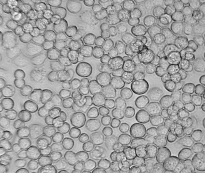 【直播推荐】flashBAC杆状病毒表达系统助力Novavax新冠疫苗开发_蛋白_进行_昆虫