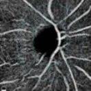 OCTA新技术，发掘RVO更多“真相”丨Euretina 2022_研究进展_患者_视网膜