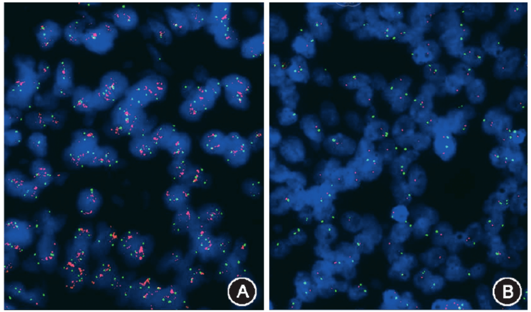 HER-2 检测深度解读，各种知识点一文搞懂！_基因_细胞_染色体