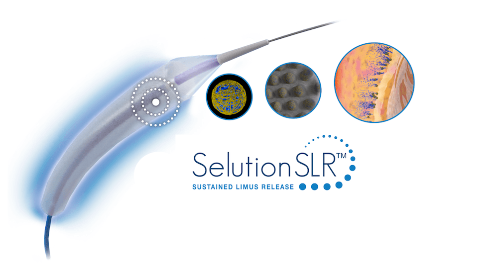 强强联合：全球血管介入巨头宣布收购知名械企_Cordis_产品_药物