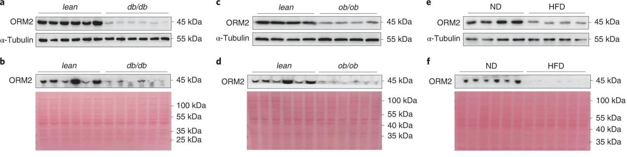 云序用户文章|IF=19.865，多组学分析助力非酒精性脂肪性肝病发病机制研究_肝脏_水平_分析
