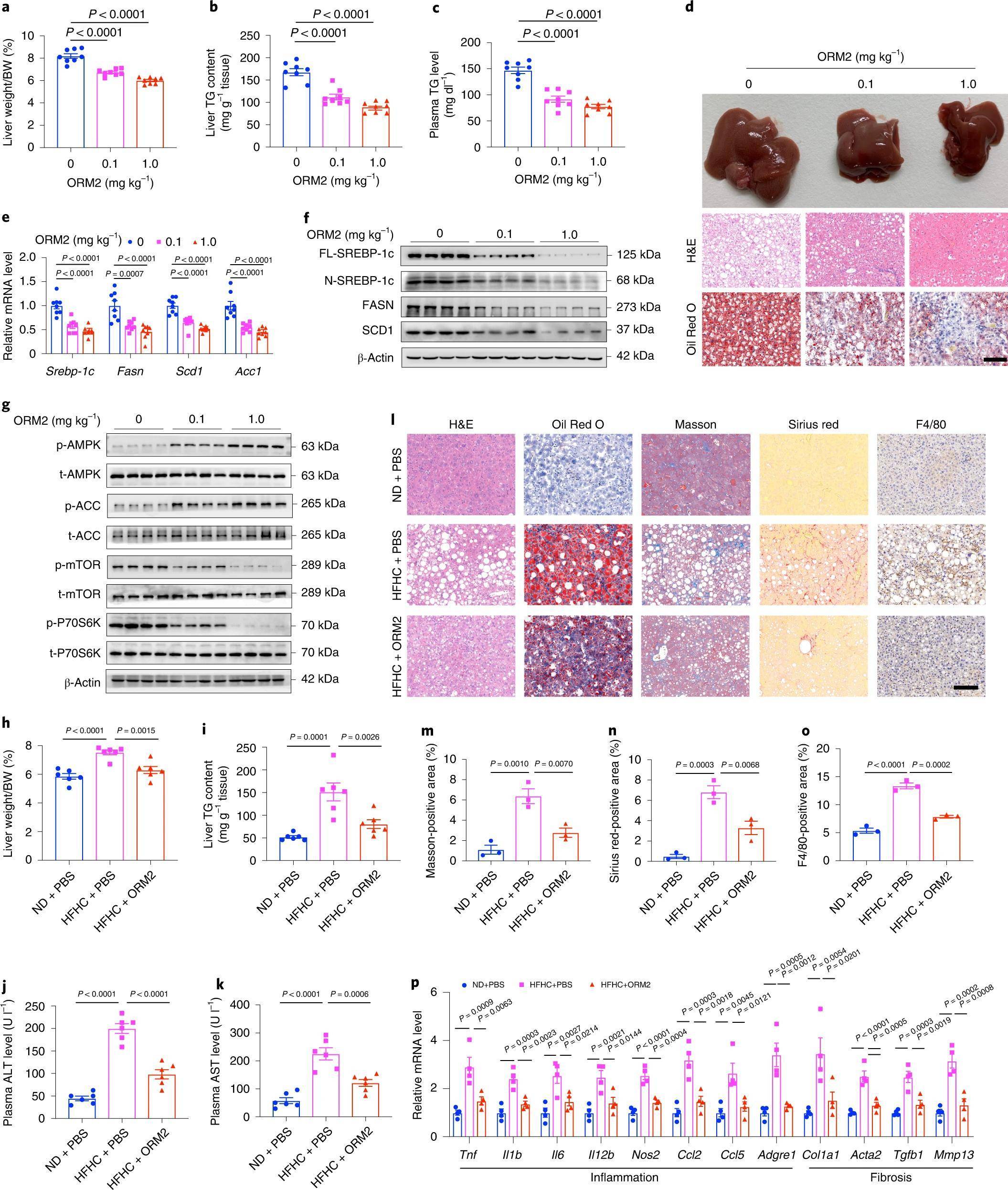 云序用户文章|IF=19.865，多组学分析助力非酒精性脂肪性肝病发病机制研究_肝脏_水平_分析