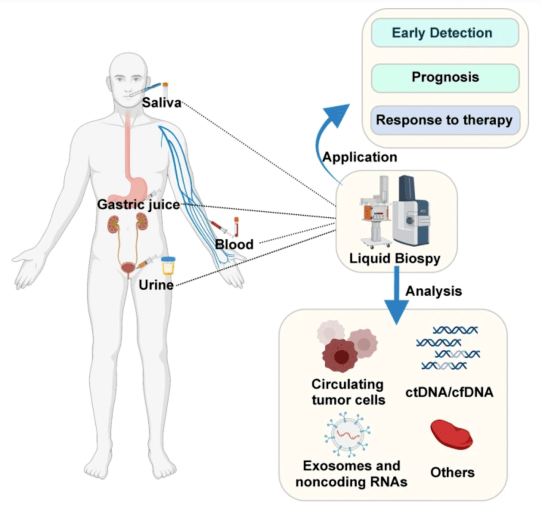 Ctc、ctdna等4种液体活检大pk！胃癌早期检测、预后｜cell Death And Diseasecfdna进行肿瘤