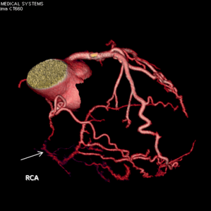 疾病诊断又添“侦察兵”！Optima CT620上线-搜狐大视野-搜狐新闻