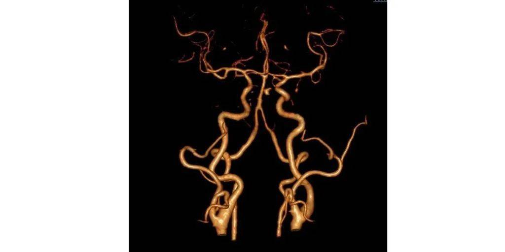 疾病诊断又添“侦察兵”！Optima CT620上线-搜狐大视野-搜狐新闻