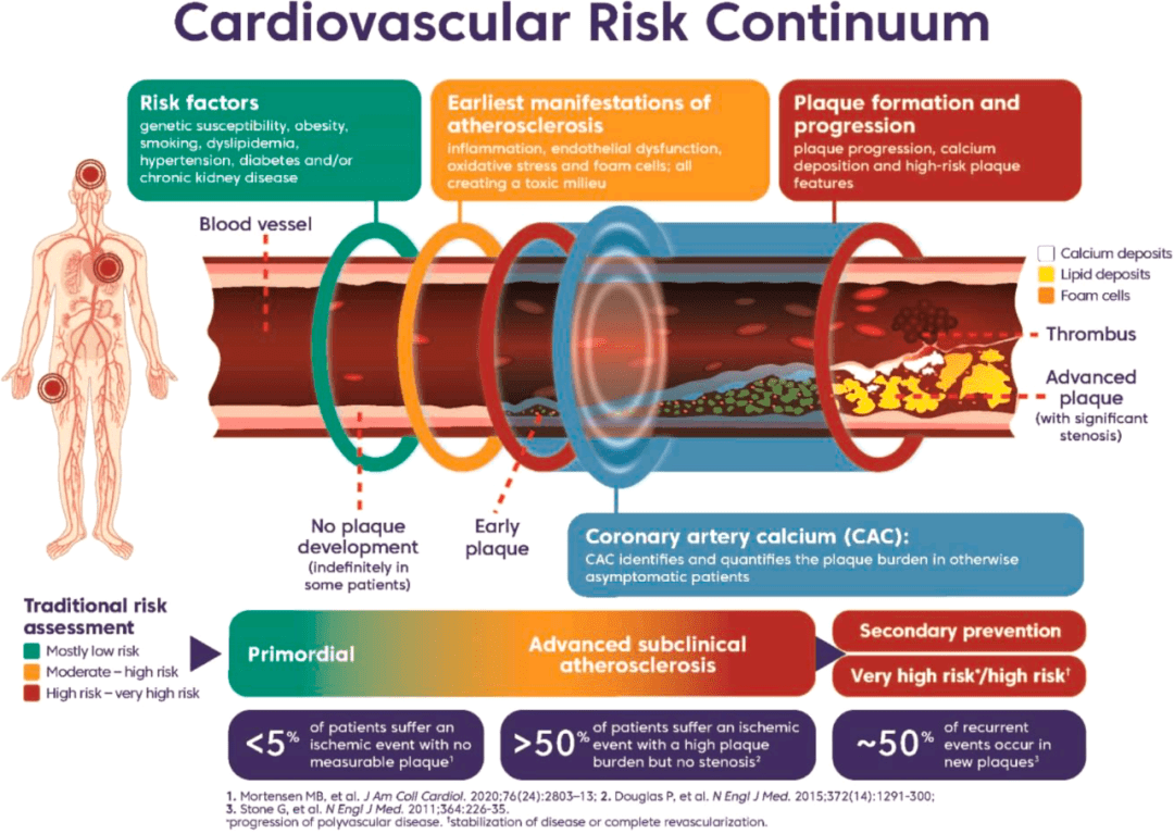 重视晚期亚临床动脉粥样硬化！预防心脏病学新观点_患者_冠脉_事件